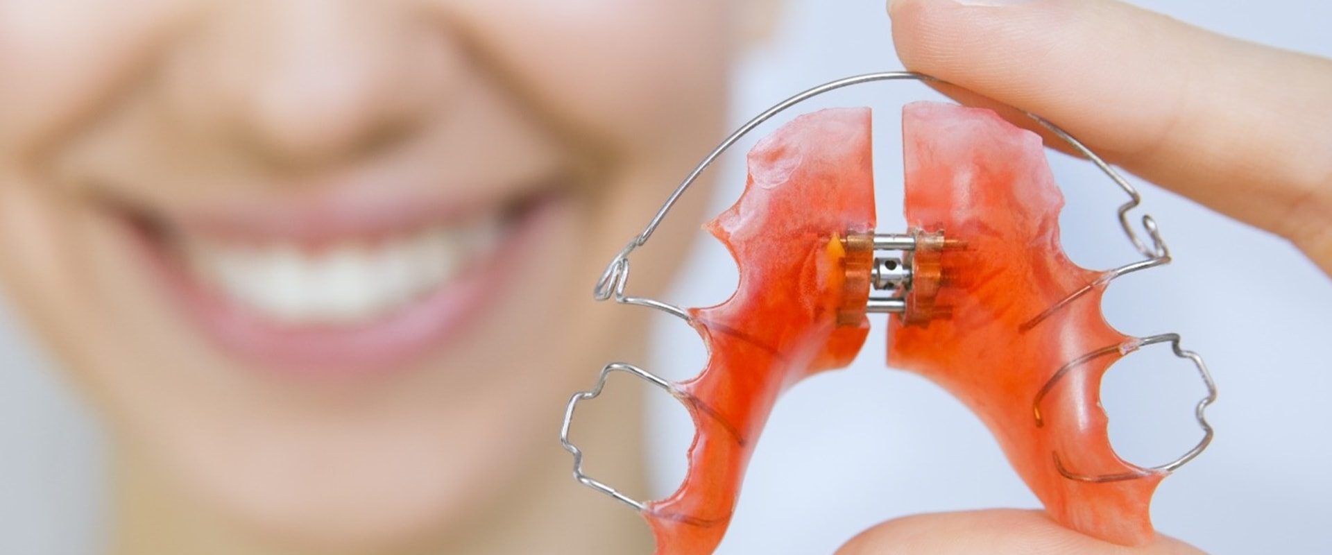 Do I Need to Wear a Retainer After Getting My Teeth Straightened?