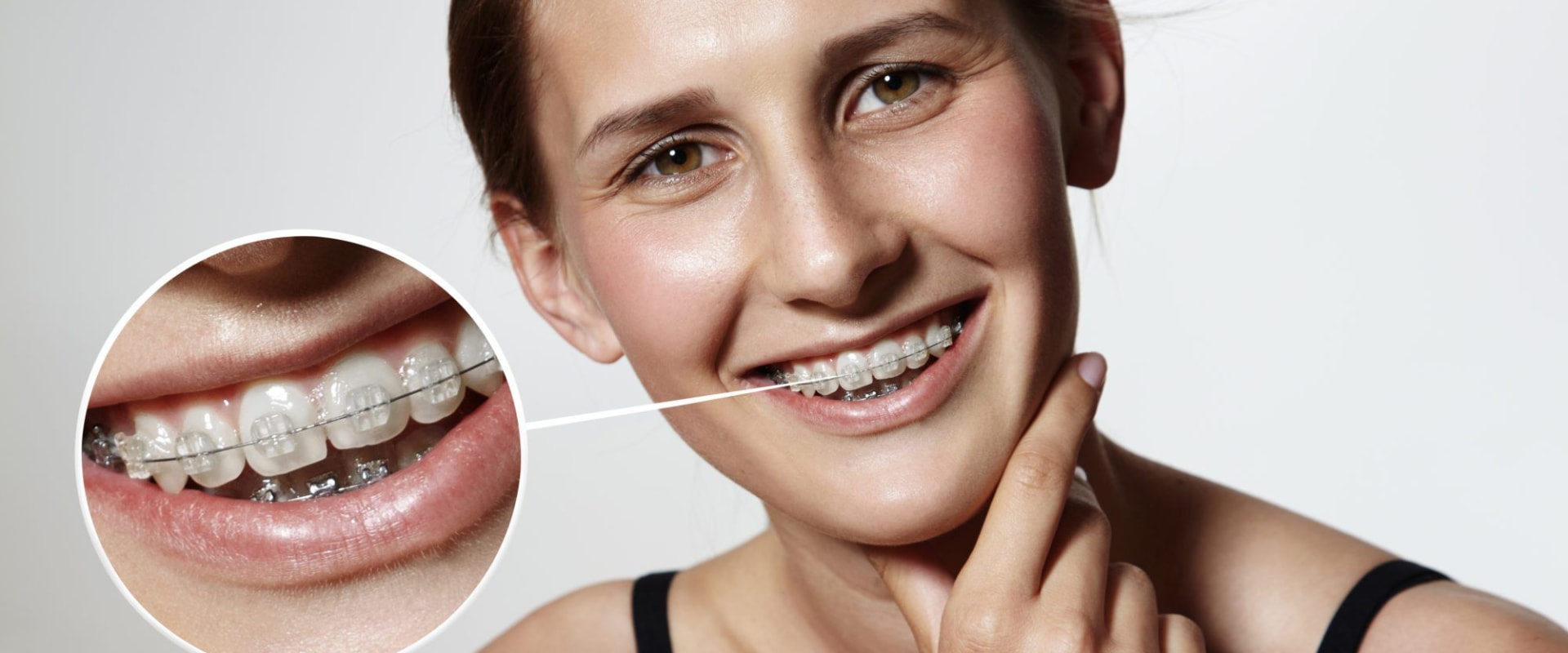 The Benefits of Straight Teeth: A Guide to Oral Health and Well-Being