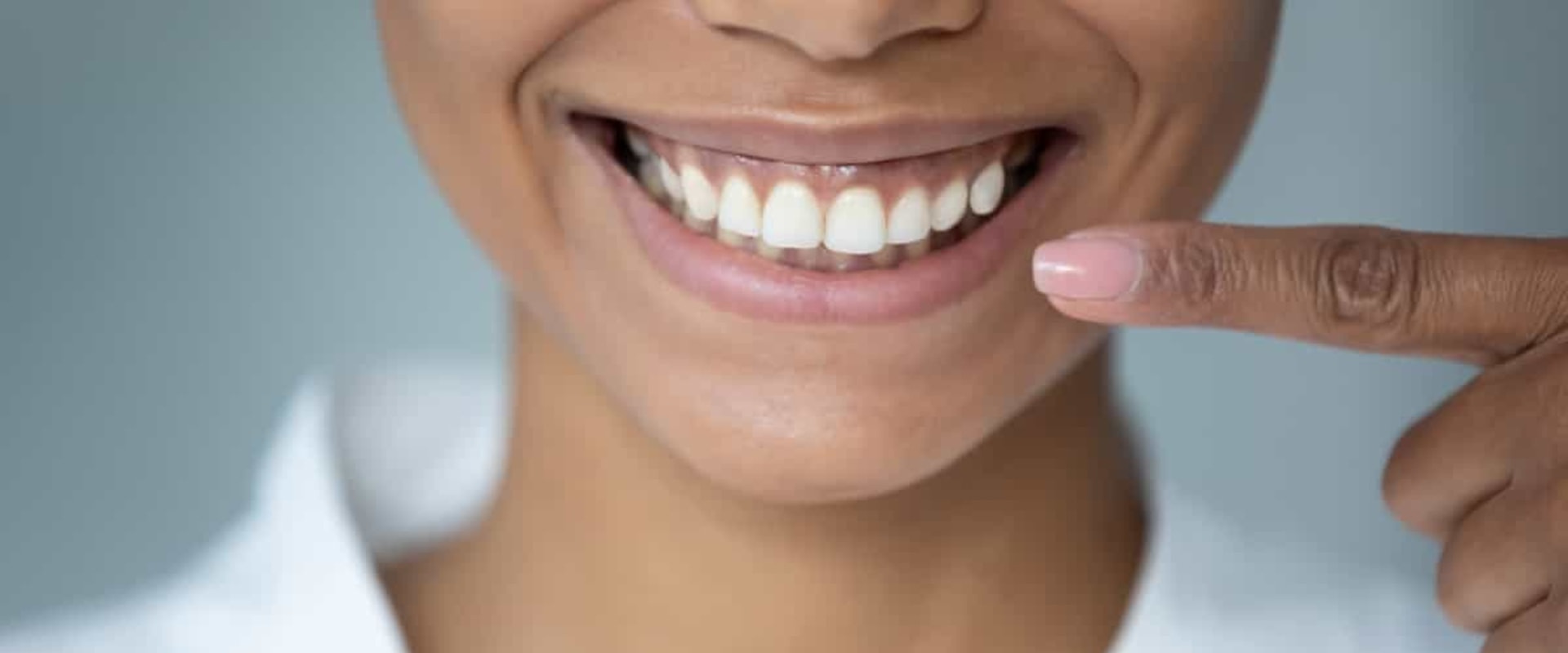 The Benefits of Straight Teeth: A Comprehensive Guide
